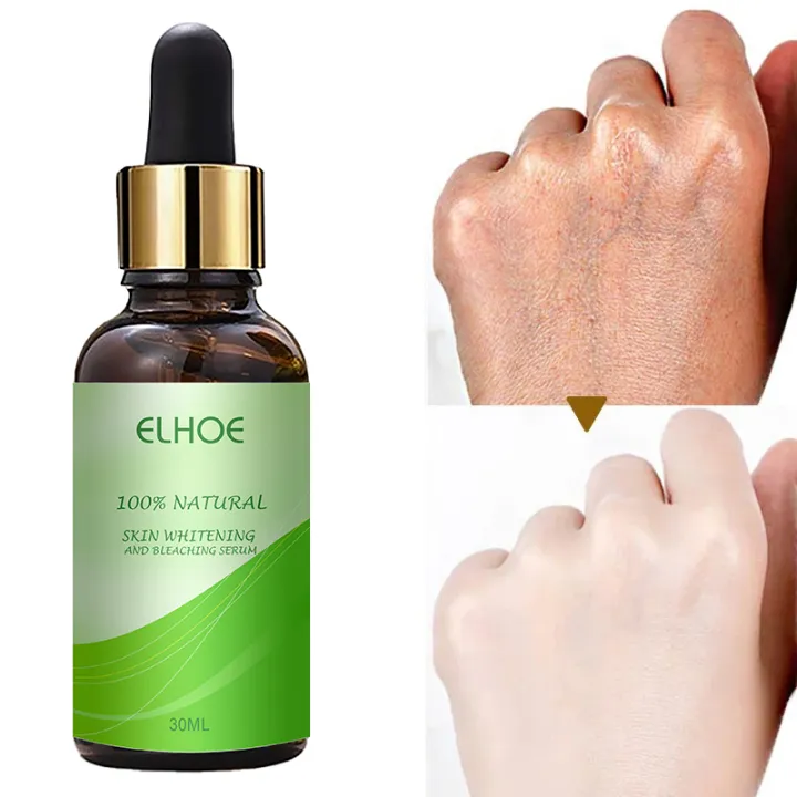 ELHOE Skin Face and Underarm Whitening serum for men and women Retinol ...