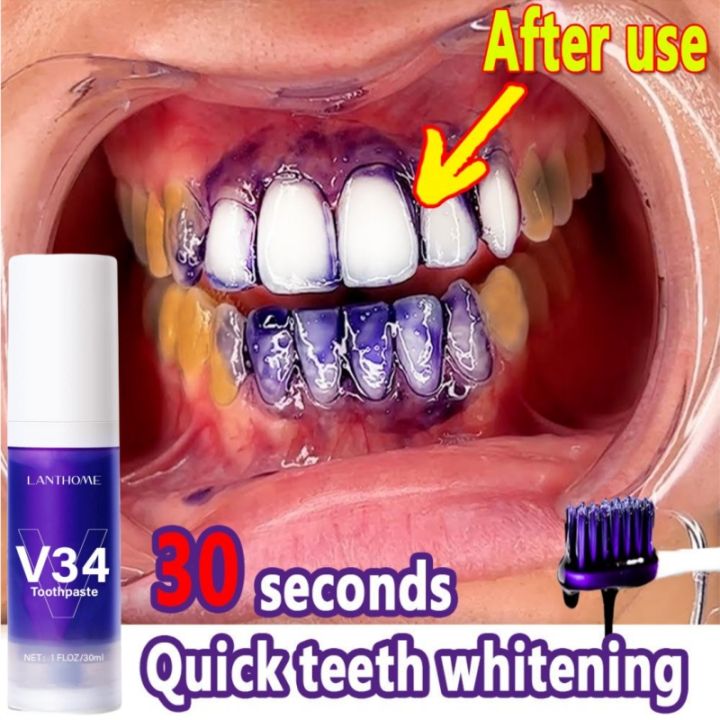 V34 Pro Whitening Toothpaste Removing Yellow Teeth Purple Corrector ...