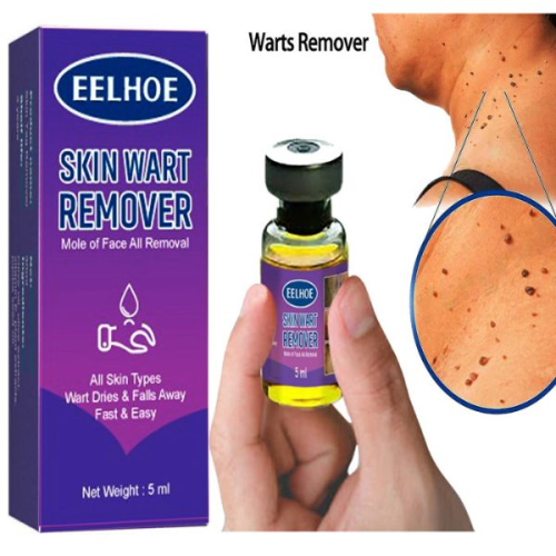 5ML Tags Moles Removal Serum Mole Skin Painless Stain Health Skin Skin ...