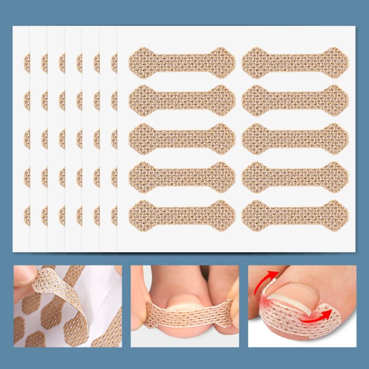 10pcs/box Nail Correction Stickers Ingrown Toenail Corrector Strips ...