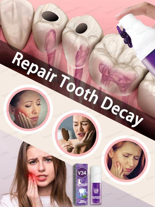 Anti Decay Toothpaste Dental Caries Repair Serum Prevent Tooth Decay ...