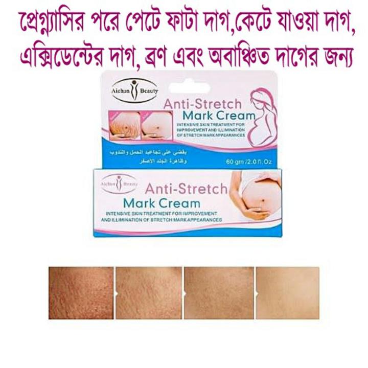 Anti Stretch Mark Cream-60 gm | Daraz.com.bd