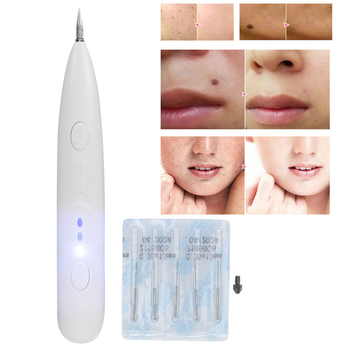 【Special Promotion】 New Laer Mole Remover Freckle Removal Tattoo LCD ...