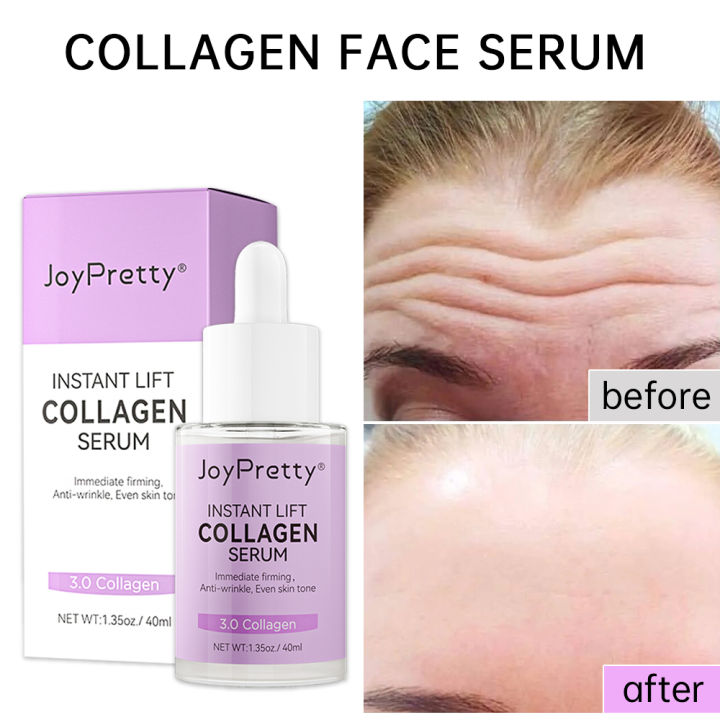 Collagen Face Serum Wrinkle Removal Anti Aging Hyaluronic Acid Forehead ...