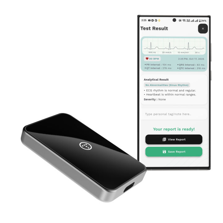 myECGai (Basic)| Portable ECG Machine | Medical Grade Single Lead ECG ...