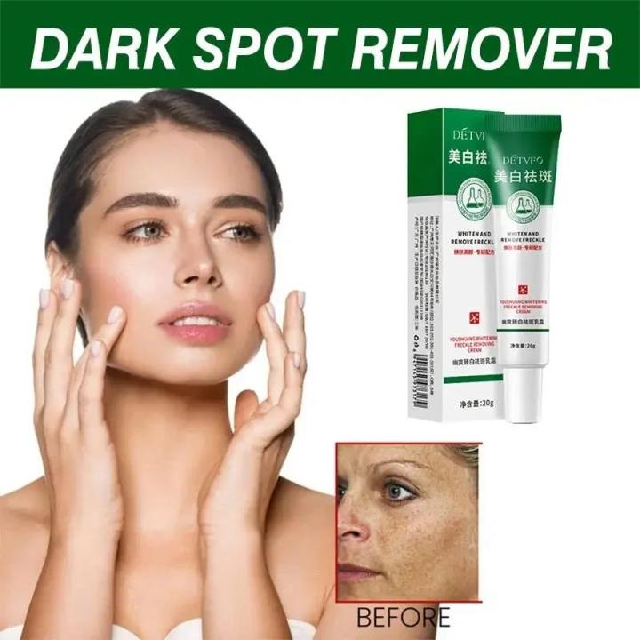 10pcs Whitening Freckle Cream Effective Remove Melasma Cream Remove Dark Spots Melanin ...