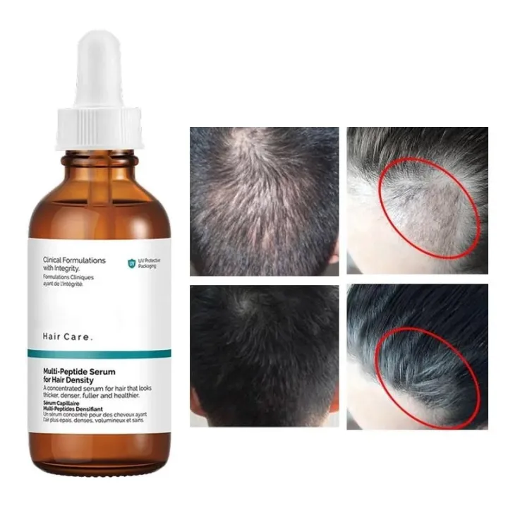 International Product Best OD Multi Pep Tide Serum For Hair Density 60 ...