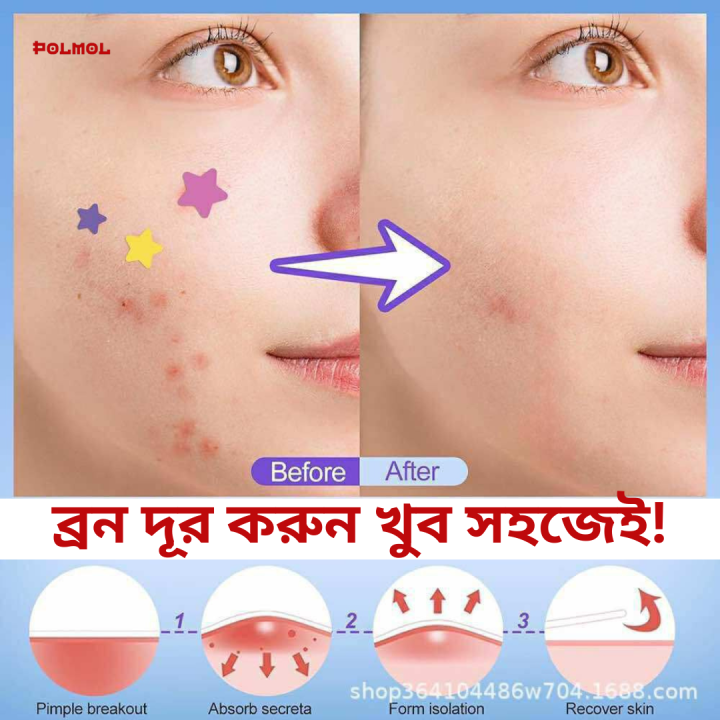 Pimple Patches for Face Hydrocolloid Acne Patches,Cute Star Zit Patches ...