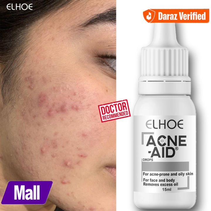 ELHOE Acne Aid Serum Drops - Your Ultimate Solution for Acne, Pimple ...