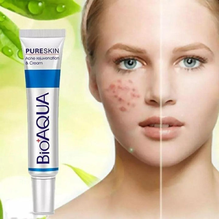 Bioaqua Pure Skin Acne Rejuvenation & Cream - 30g | Daraz.com.bd