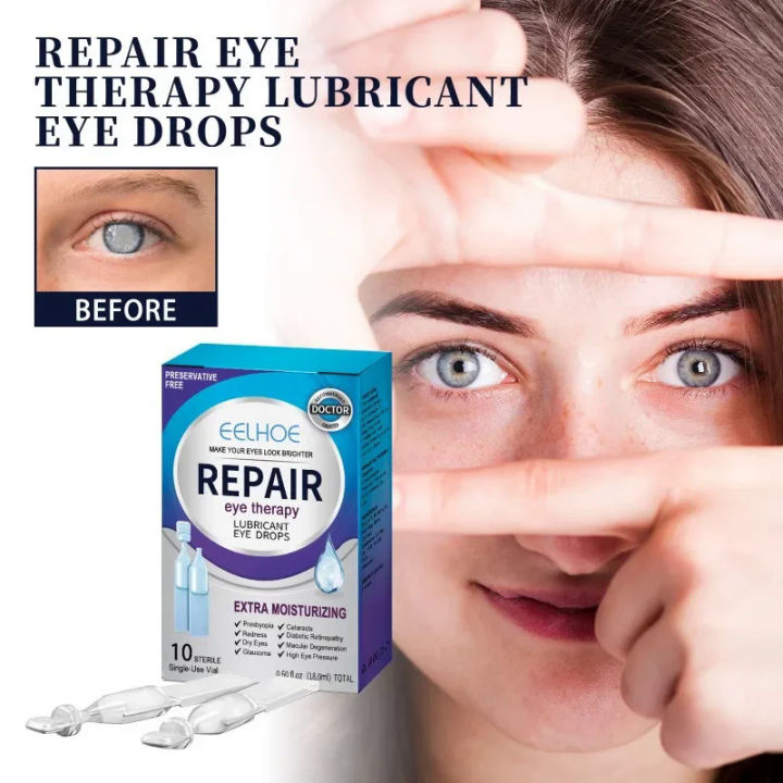Eye Drop Improve Eyesight Protection Relieve Eyes Fatigue Dry Itchy ...
