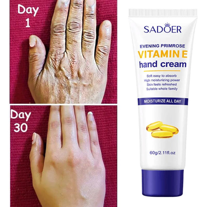 In blue In Whitening Hand Cream Wrinkle Remover Anti crack Moisturizing ...