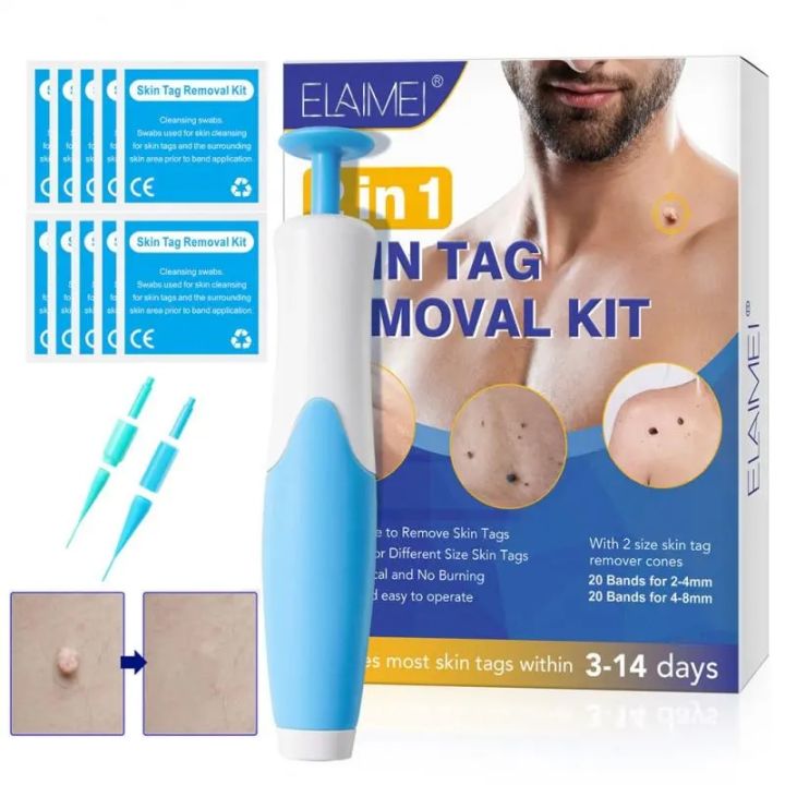 2 In1 Painless Auto Skin Tag Mole Wart Removal Kit Cleaning Tools Face ...