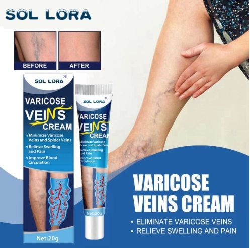 1pcs Vein ointment Blue Mai Lishu ointment Earthworm leg cream | Daraz ...