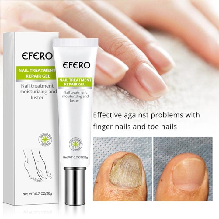 Nail Repair Gel Fungus Treatment Solution Anti Fungal Removal Infection ...