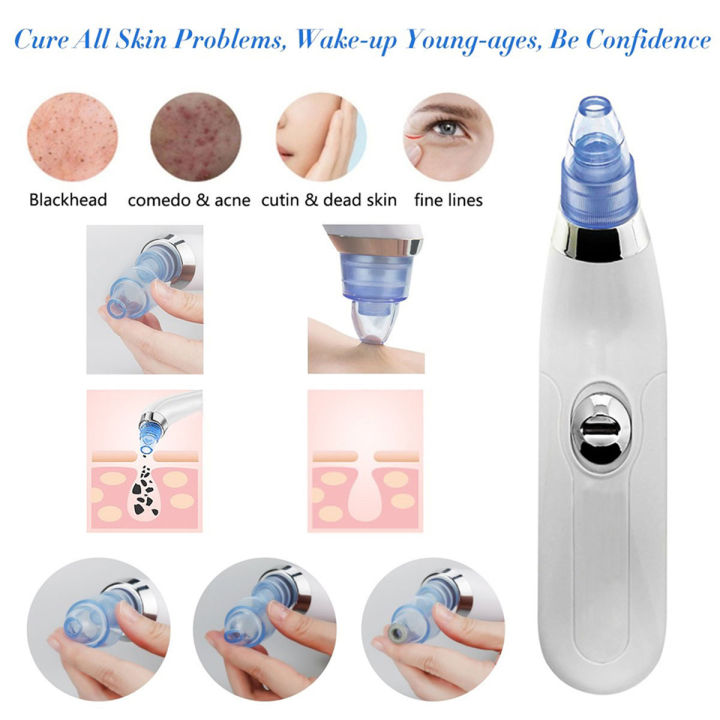 Clean Blackhead Machine Electric Blackhead Remover Skin Care Device ...