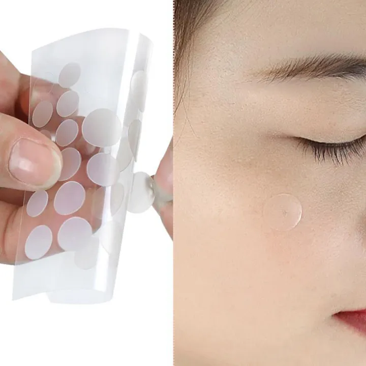 72Pcs Acne Pimple Patch Invisible Acne Stickers Pimple Remover Beauty ...