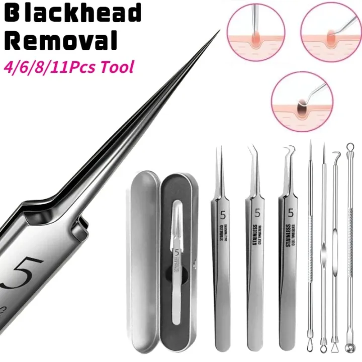 German Acne Remover Needles Blackhead Removal Pimple Comedone Extractor ...
