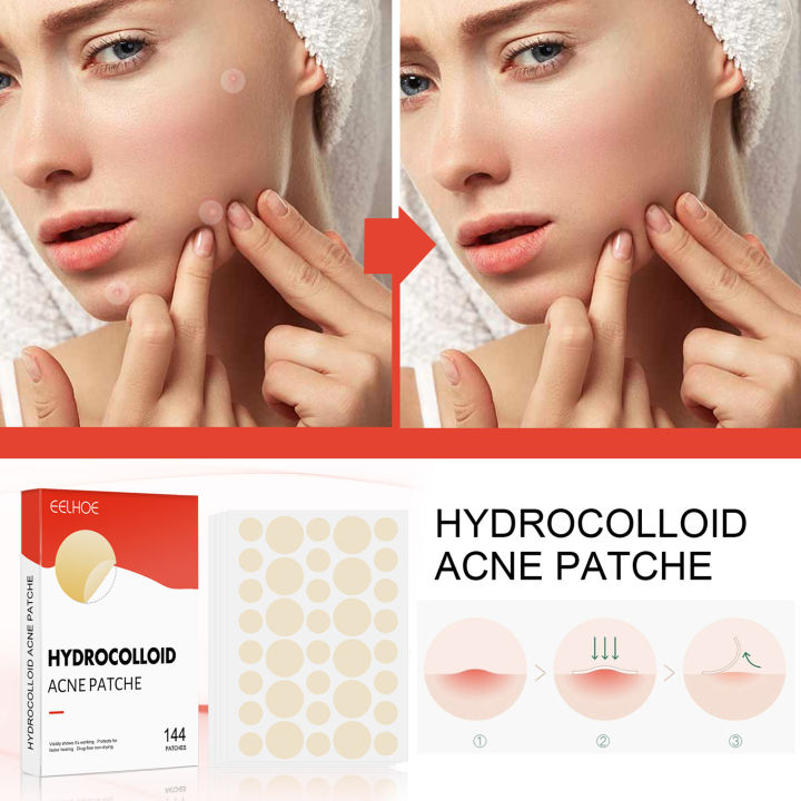 144Pcs Acne Pimple Patch Acne Cover Patches Ollie Belle Hydrocolloid ...