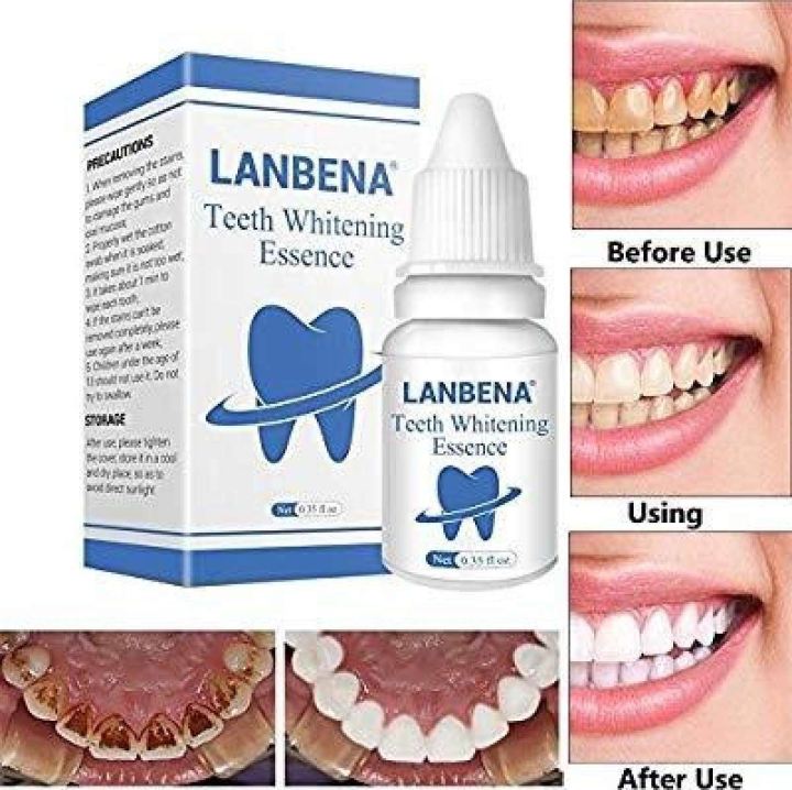 Smokers Teeth Whitening Smoke Stain Tea Stain Tartar Tooth Cleaning ...
