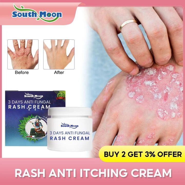 Eczema Treatment Cream Dermatitis Anti Itching Inhibit Fungi Urticaria ...