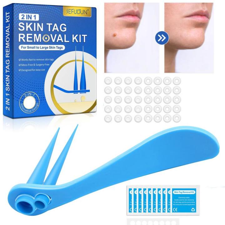 Remove Skin Tags Skin Tags Removal Tool With Two Cones 2mm 9mm Wart ...