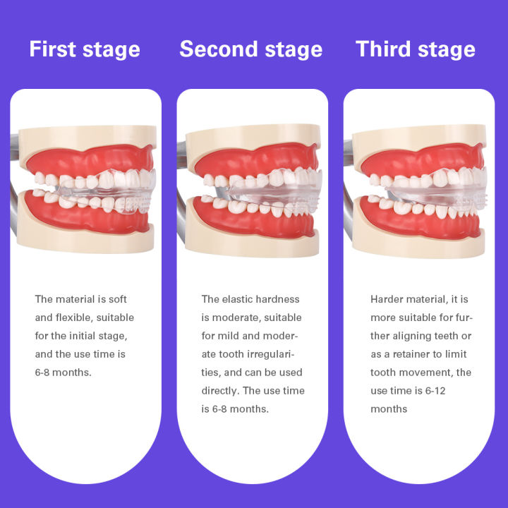 HOT OLIECO Dental Tooth Orthodontic Appliance Trainer for Alignment ...