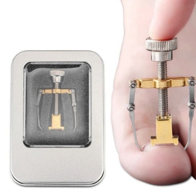 Stainless Steel Ingrown Nail Corrector Fixer Manicure Pedicure Foot ...