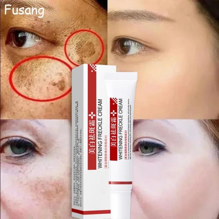 Women Fade Melasma Cream Lightening Dull Brightening Emulsion Reduce ...