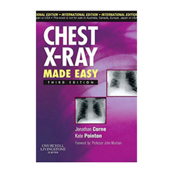 Chest X-Ray Made Easy 3rd Edition (Printed book) | Daraz.lk