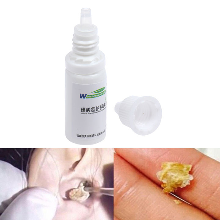 10ml Ear Drops Sodium Bicarbonate Earwax Cleaner Otitis Tinnitus ...