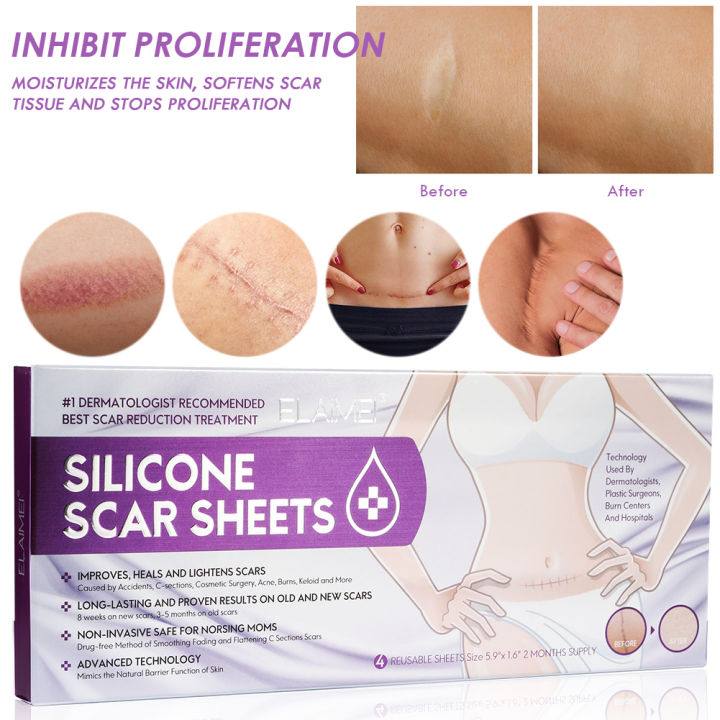Scar Removal Patch Reusable 4pcs Correctors Burn Patch Lightweight ...