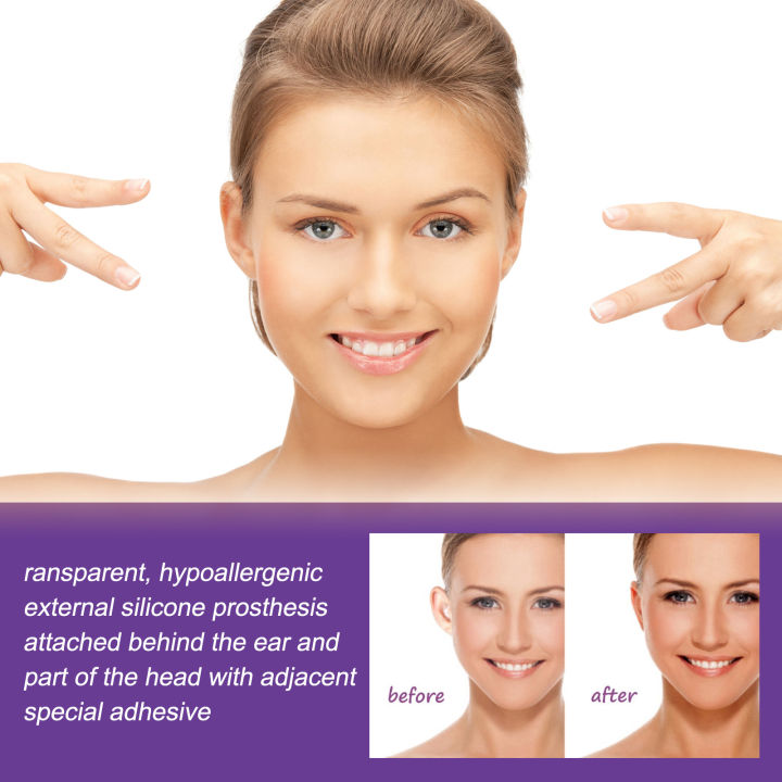 Ear Corrector Sticker Contour Shaping Auricle Valgus Correction Big ...