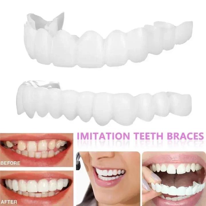 Perfect Fit Teeth Whitening Tooth Cover Snap On Silicone Smile Veneers ...