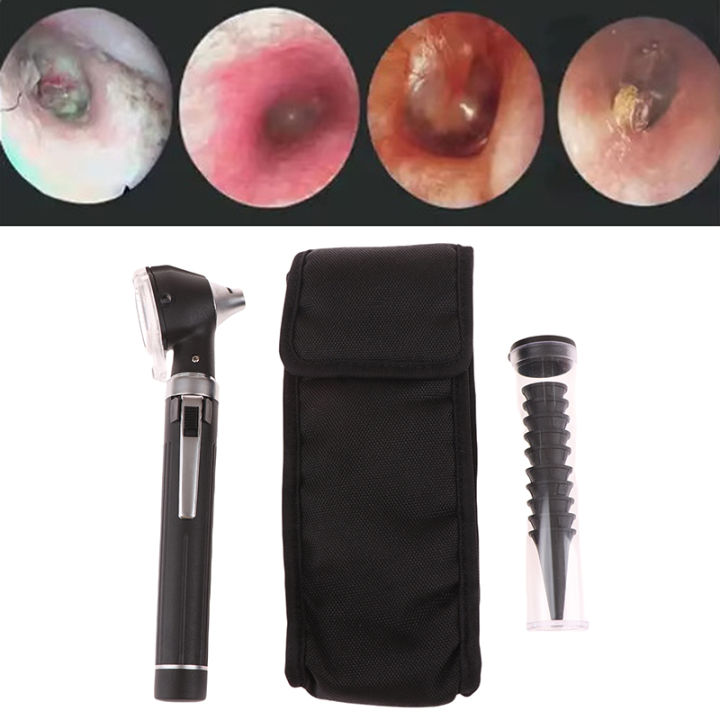 Professional Portable Ear Care Examination Otoscopio Eardrum Endoscope ...