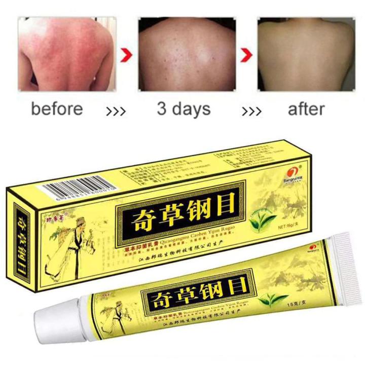 Advanced Body Psoriasis Cream For Dermatitis Eczema Skin Rash Natural ...