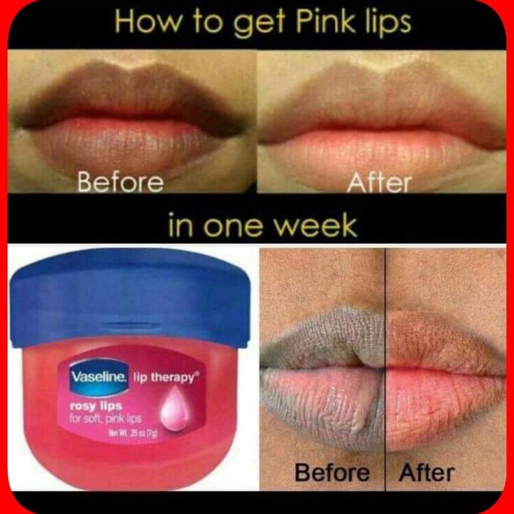Vaseline Lip Therapy Rosy Lips 7g, Mini Heals, Relieves Dry, Dull And ...