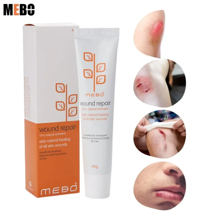 MEBO Anti-infection Cream Antibacterial Bureliablern Wound Care ...
