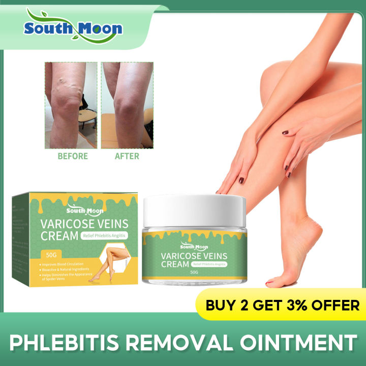 Phlebitis Treatment Cream Dilated Vasculitis Smoothing Spider Pain ...