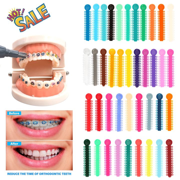 40Sticks / Pack Dental Orthodontic Elastic Ligature Ties for Brackets ...