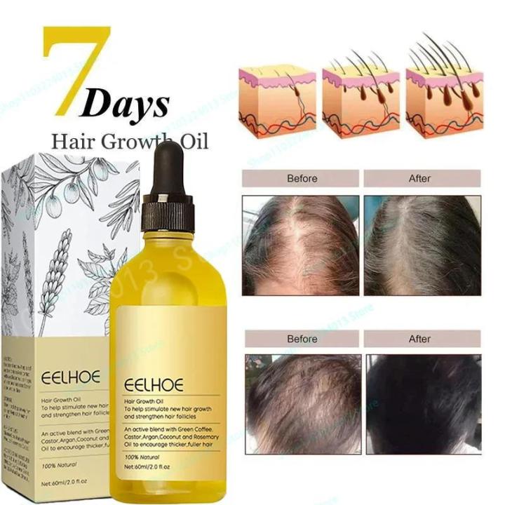 Fast Hair Growth Oil Hair Regrowth Serum Hair Thinning Treatment Hair ...