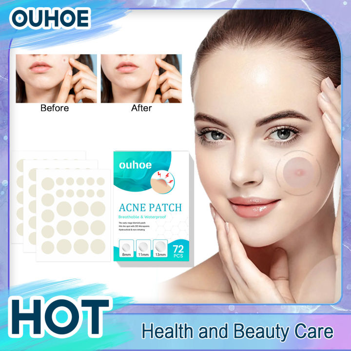 Acne Pimple Patch Waterproof Healing Absorbing Blemish Spot Facial Mask ...