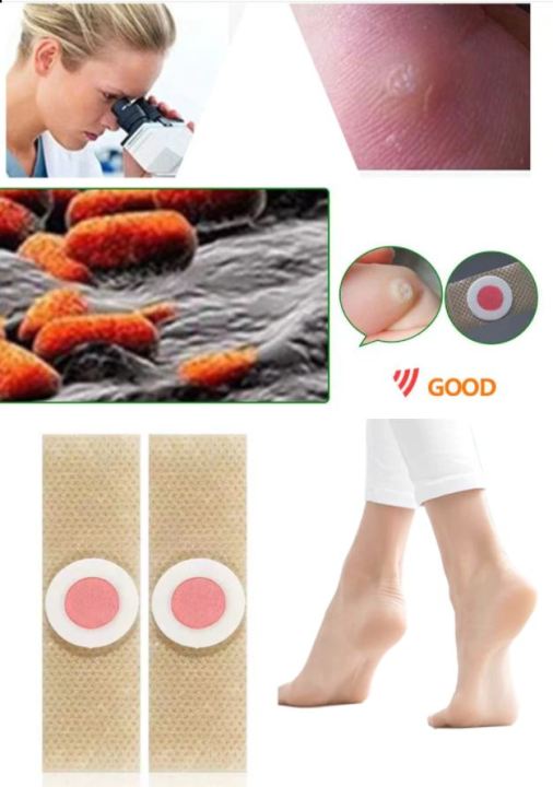 Foot Care Stickers Plaster Corns Patches Foot Corn Removal Plaster ...