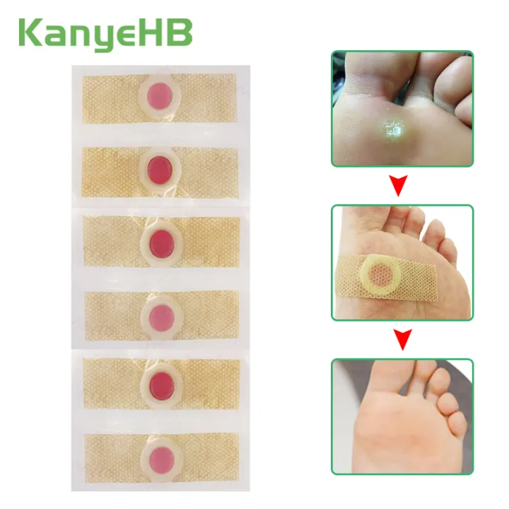 【TrendGlobe】12pcs Medical Plaster Foot Corn Removal Calluses Plantar ...