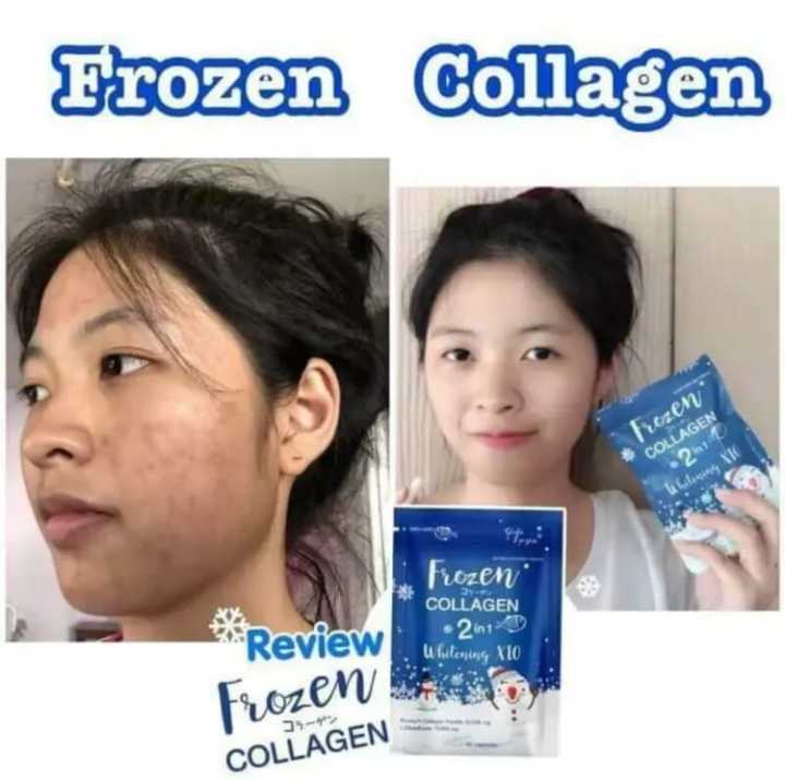 Frozen Collagen Skin with Glutathione capsules 60 | Daraz.lk