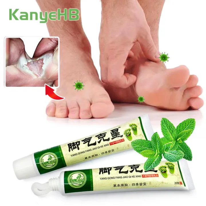 Beautiful Day 2pcs Foot Anti-itch Antifungal Cream Mint Tinea Pedis ...