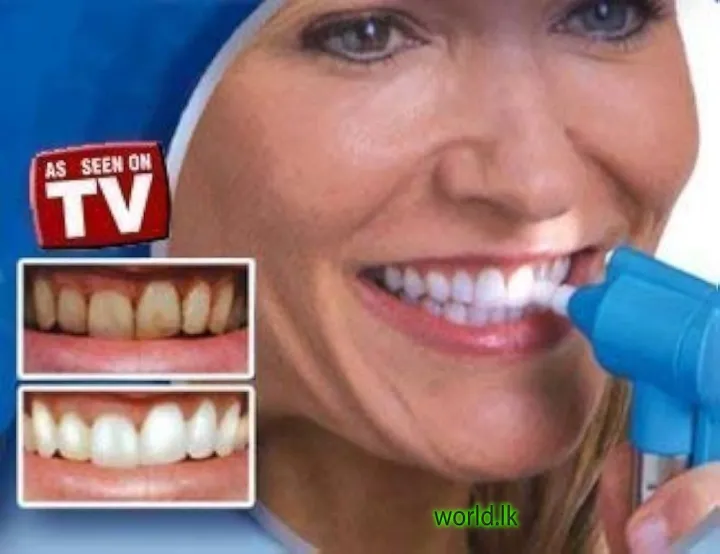 Whitte*ening Teeth Dental Smile Machine Stain Remover Tool Kit Dmrt ...