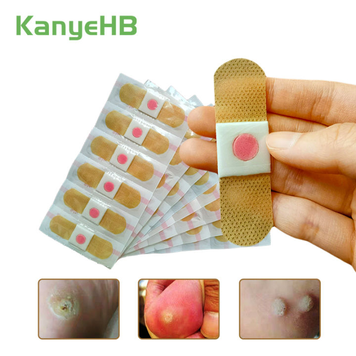 【TrendGlobe】30pcs New Foot Corn Removal Plaster Warts Thorn Remove Corn ...