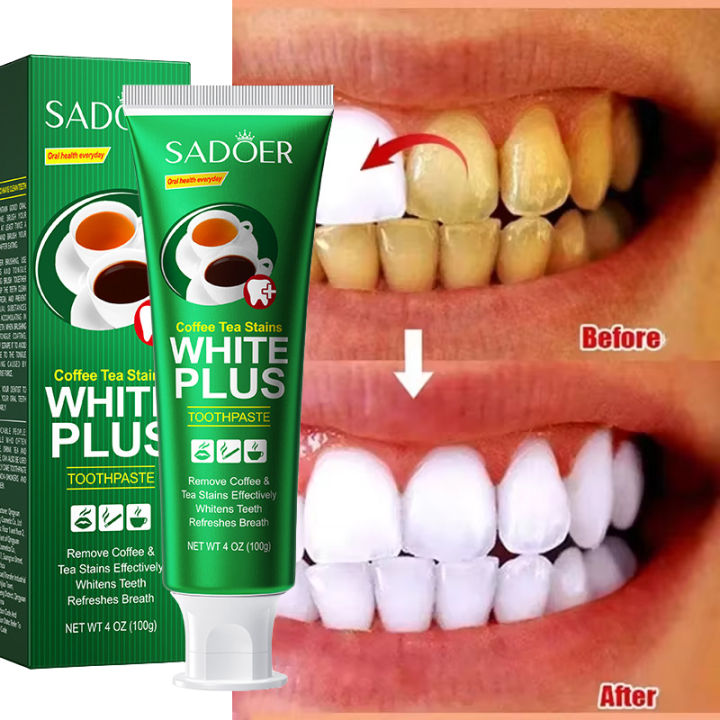 Teeth Whiten Toothpaste Fast Remove Plaque Smoke Coffee Tea Stains ...