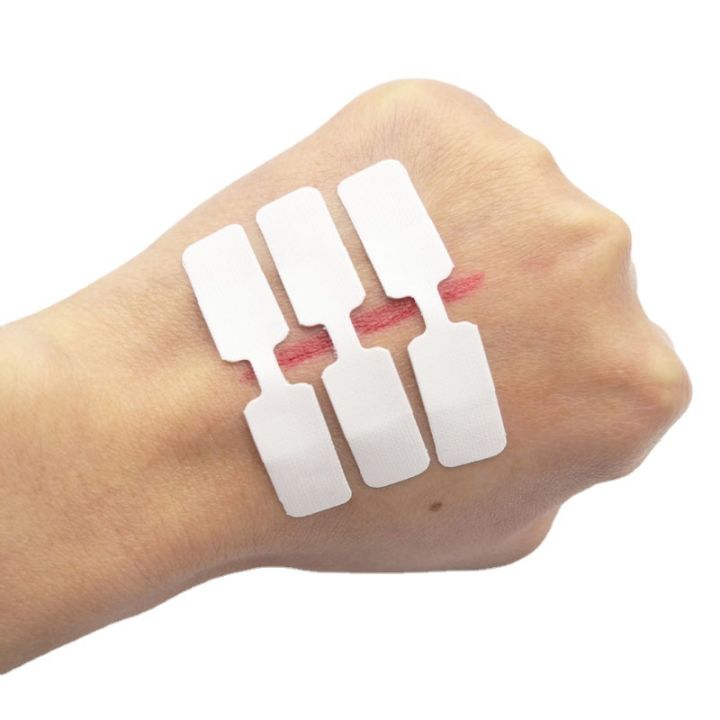 20pcs/lot Sutureless Wound Plaster Patch Band Aid for Scratched Incised ...